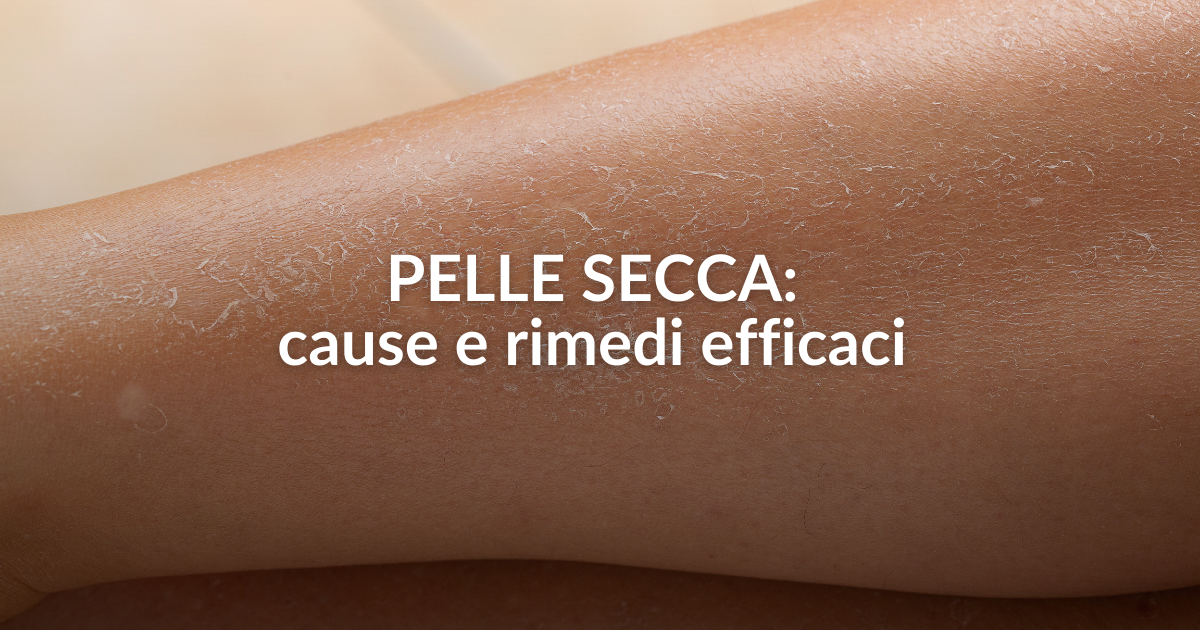 Pelle secca: cause e rimedi efficaci